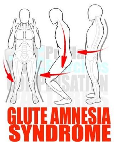 Dawn Shepard | "Glute Amnesia." Yes, it is a Real Thing.